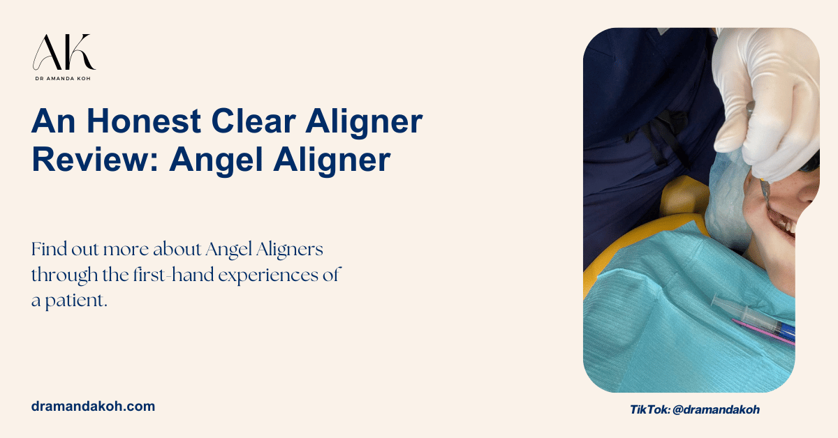 An Honest Clear Aligner Review: Angel Aligner | Dr Amanda Koh